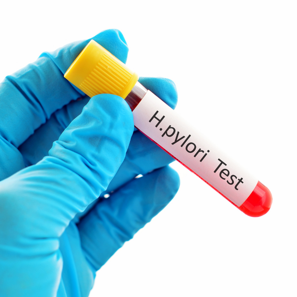 Hpylori test